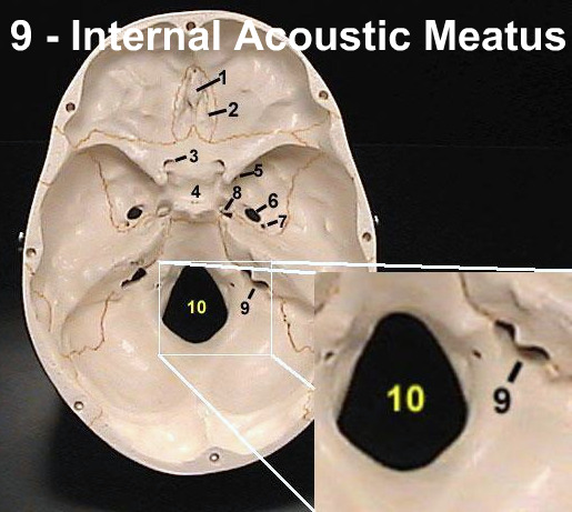 C. Nerve VIII :: Cranial Nerves VIII to XII